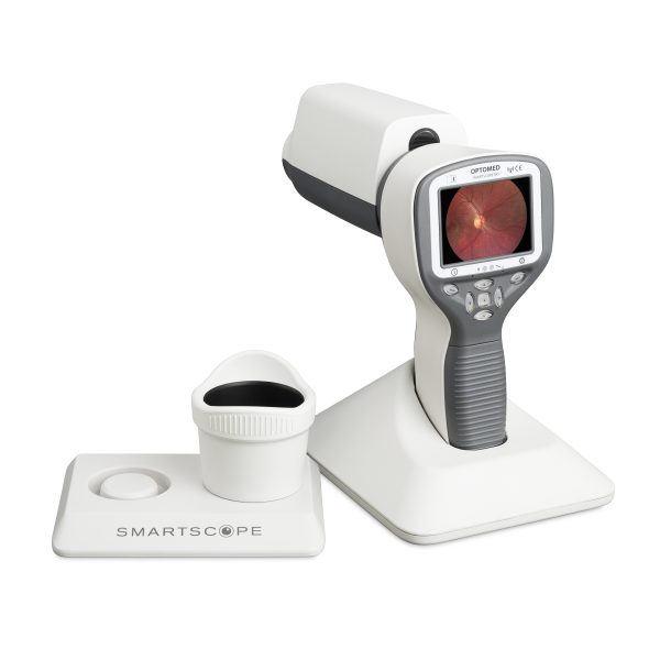 Smartscope Pro Fundus Camera | an-vision