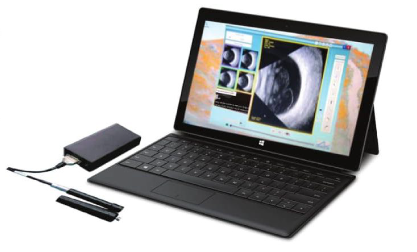 UltraView XL Diagnostic Ultrasound | an-vision