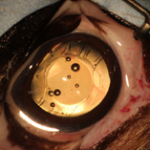 an-PLD - Preloaded Intraocular Lens for Dogs | an-vision