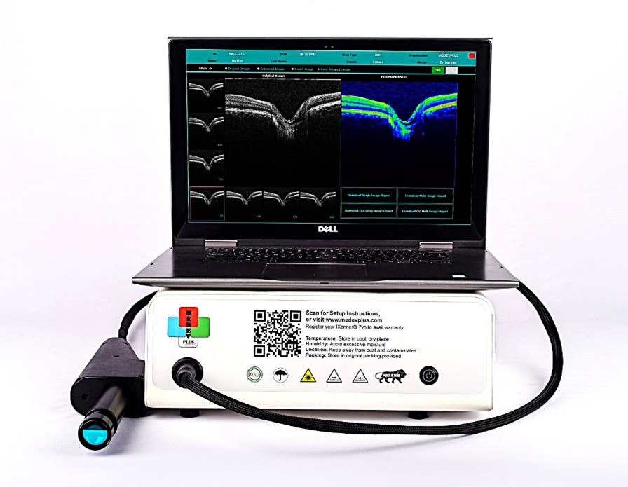 IXanner 7vn - Portable OCT | an-vision
